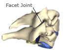 Facet Joint Arthritis - Spine Care | UCLA Health