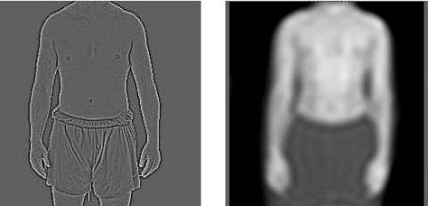 Partially overlapping patterns of brain function found in anorexia and ...