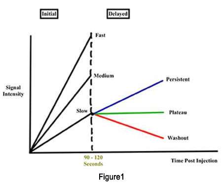 Breast MRI Findings: Kinetics - Radiology | UCLA Health