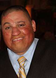 Meet Our Warriors - Operation Mend | UCLA Health