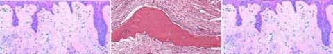 Bone & Soft Tissue Pathology - Pathology | UCLA Health