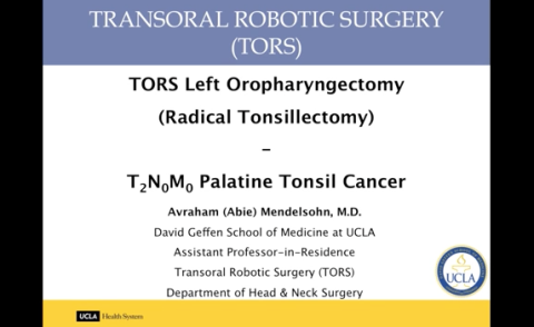 How I Do It - Head & Neck Surgery | UCLA Health