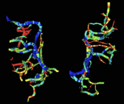 UCLA Neurovascular Imaging Core: Seeing Inside Every Brain to Improve ...