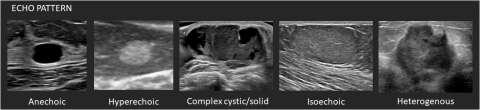 Ultrasound: Masses - Radiology | UCLA Health
