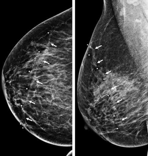 Case: Vascular Abnormalities - Radiology | UCLA Health
