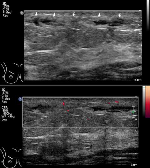 Case: Vascular Abnormalities - Radiology | UCLA Health
