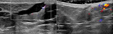 Case: Skin Lesion - Radiology | UCLA Health