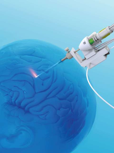 Novel procedure helps treat New Zealand teen with brain cancer | UCLA ...