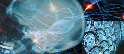 Diagnostic Neuroradiology - Radiology | UCLA Health