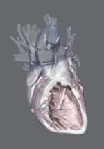 Stereotaxis - Heart and Vascular Services | UCLA Health