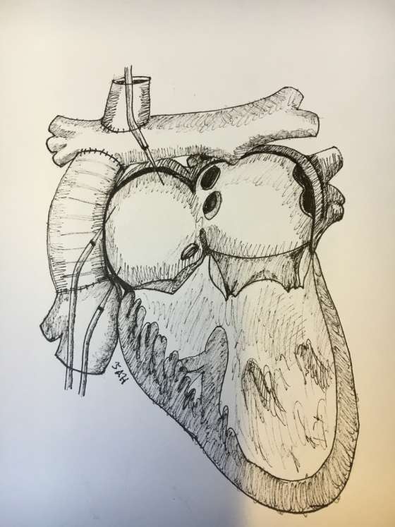 How drawing and painting inspire this doctor’s cardiology practice ...