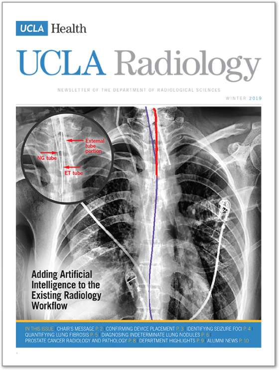 Newsletter - Radiology | UCLA Health