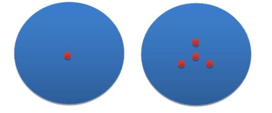 Breast Cancer – Brachytherapy - Radiation Oncology | UCLA Health ...