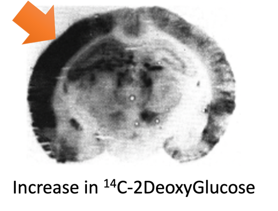 History of BIRC Research - Neurosurgery | UCLA Health