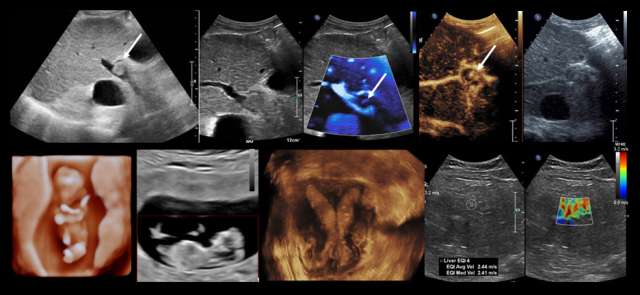 Ultrasound in Los Angeles, CA - Radiology | UCLA Health