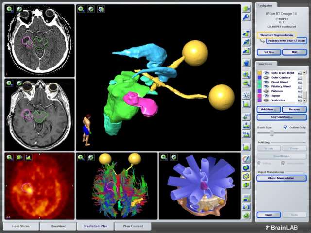 Functional Image-Guided Radiation Therapy - Radiation Oncology | UCLA ...