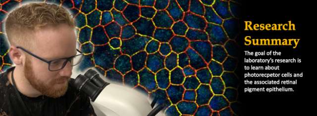 Retinal Cell Biology - Ophthalmology | UCLA Health