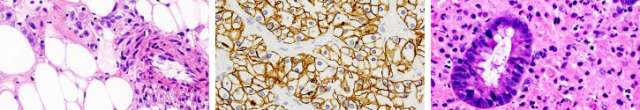 Surgical Pathology - Pathology | UCLA Health