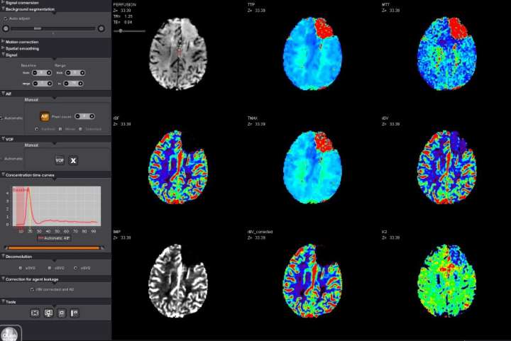 Neuroradiology - Q3D Imaging Lab | UCLA Health