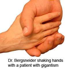 Gigantism Symptoms & Treatment - Pituitary & Skull Base Tumor | UCLA Health