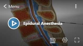 Anesthesia for Labor & Delivery - Anesthesiology | UCLA Health