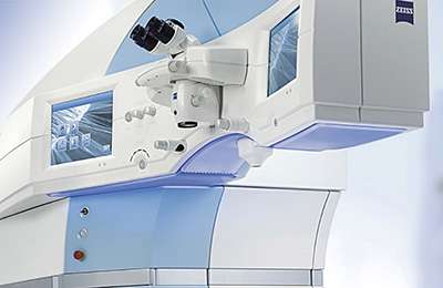 Your Visit - Laser Refractive Surgery | UCLA Health