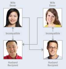 Kidney Swap - Kidney Exchange | UCLA Health