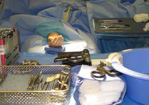 Hand Transplant Procedure - Hand Transplant | UCLA Health