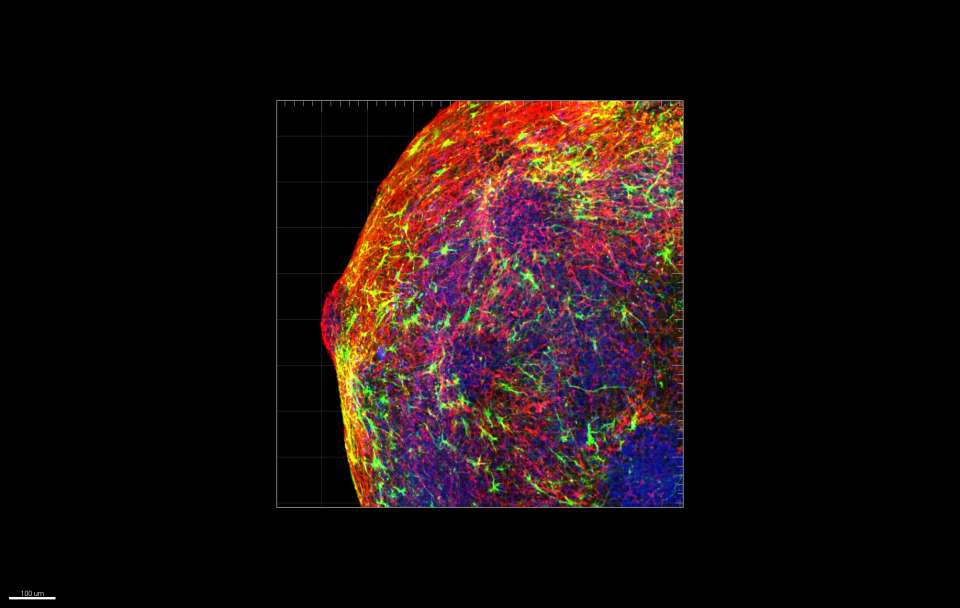 Rare mutation in autism risk gene connects family with researcher ...