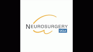 Dural Arteriovenous Fistula (DAVF) - Cerebrovascular Disease | UCLA Health
