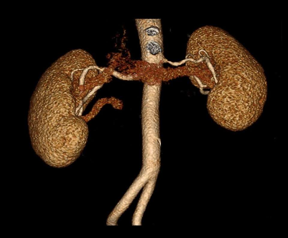 Abdominopelvic - Q3D Imaging Lab | UCLA Health