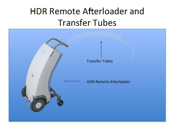 Brachytherapy at UCLA - Radiation Oncology | UCLA Health
