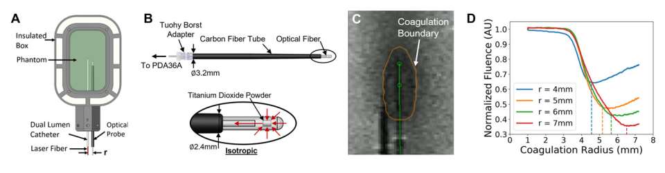 Focal Laser Ablation for Prostate Cancer Treatment - CASIT | UCLA Health