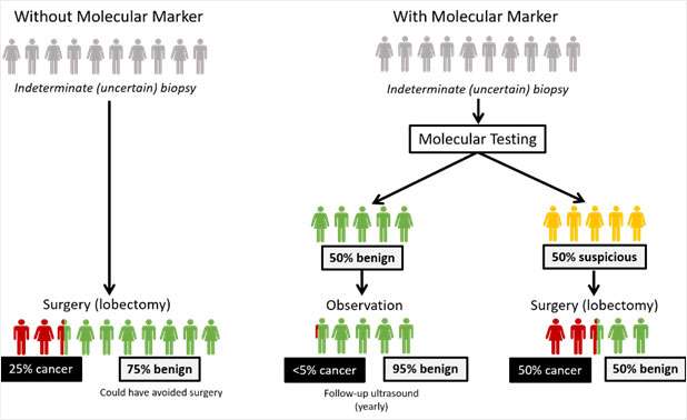 Thyroid Nodules & Thyroid Cancer - Endocrine Surgery | UCLA Health
