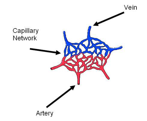 Arteriovenous Malformation - Interventional Neuroradiology | UCLA Health