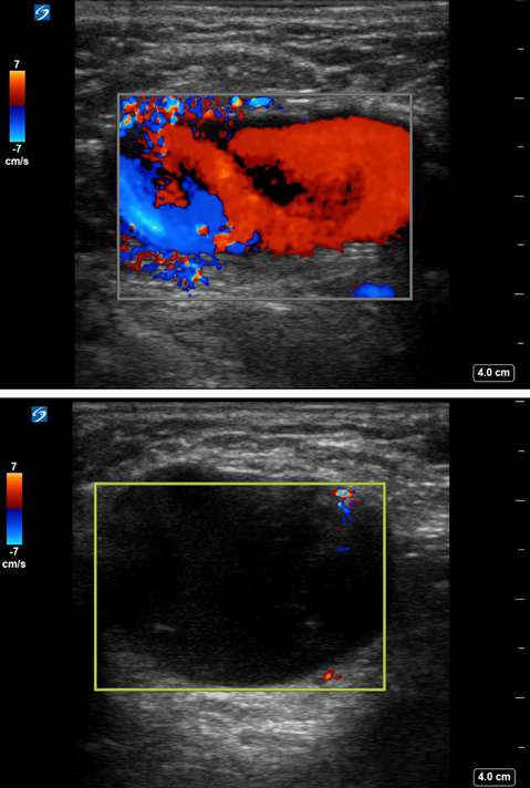 Case: Vascular Abnormalities - Radiology | UCLA Health