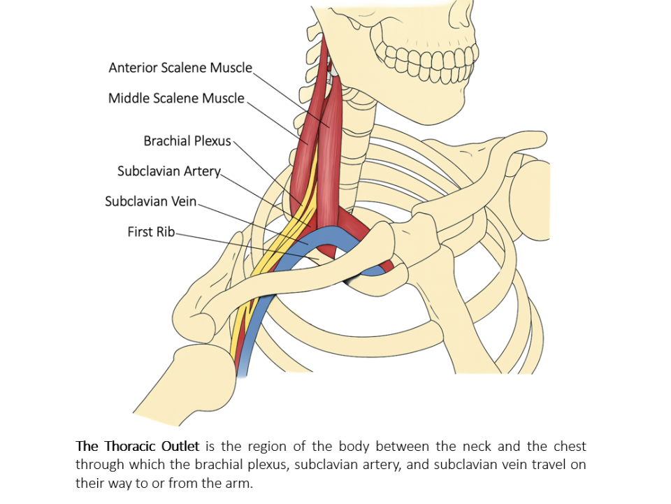 Thoracic Outlet Syndrome - Thoracic Surgery | UCLA Health