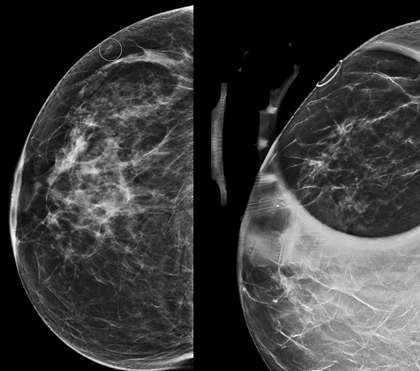 Case: Skin Lesion - Radiology | UCLA Health