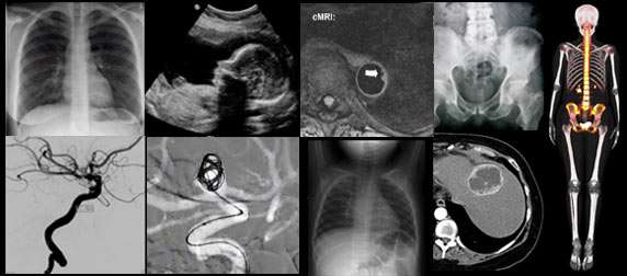 Imaging Specialties - Radiology | UCLA Health