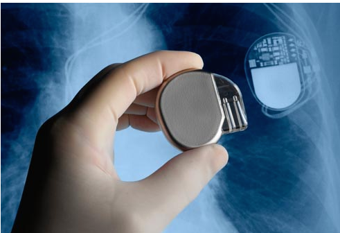 Cardiac Device Implantation - Cardiac Arrhythmia | UCLA Health