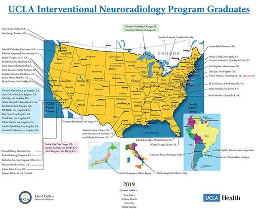 Interventional Neuroradiology - Radiology | UCLA Health