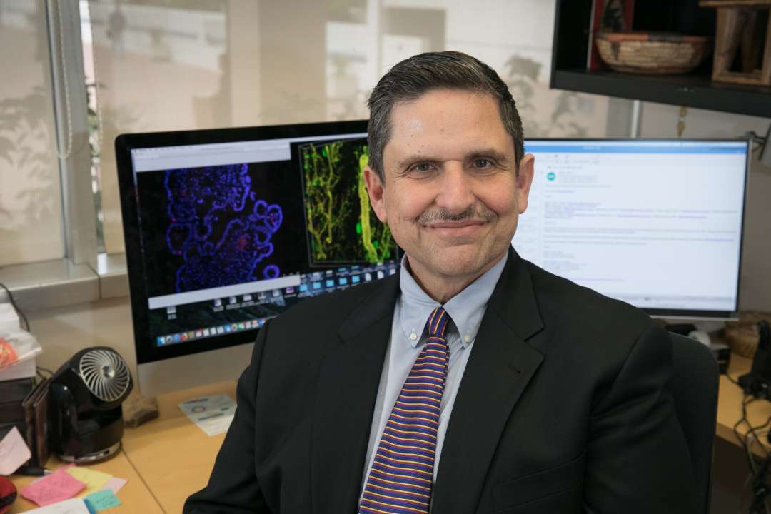 Multi-center study uncovers genetic underpinnings of congenital ...