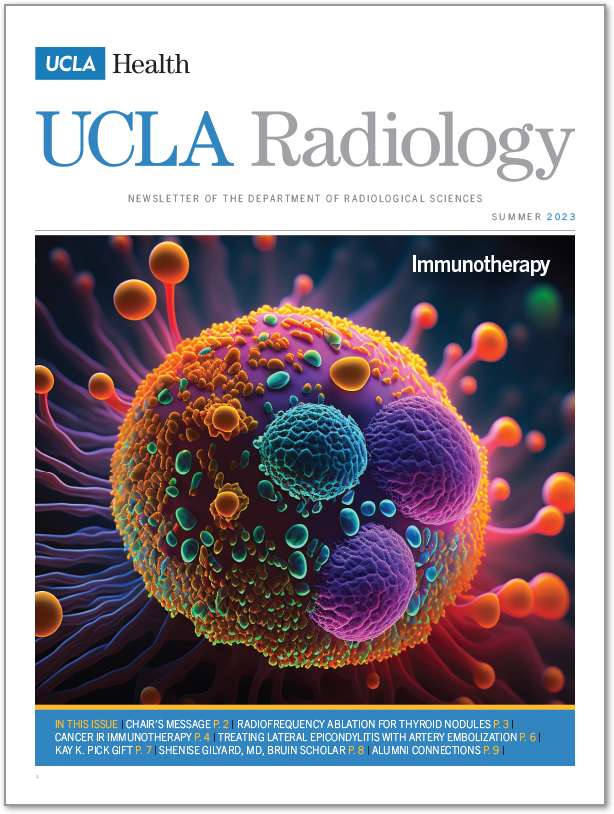 Newsletter - Radiology | UCLA Health
