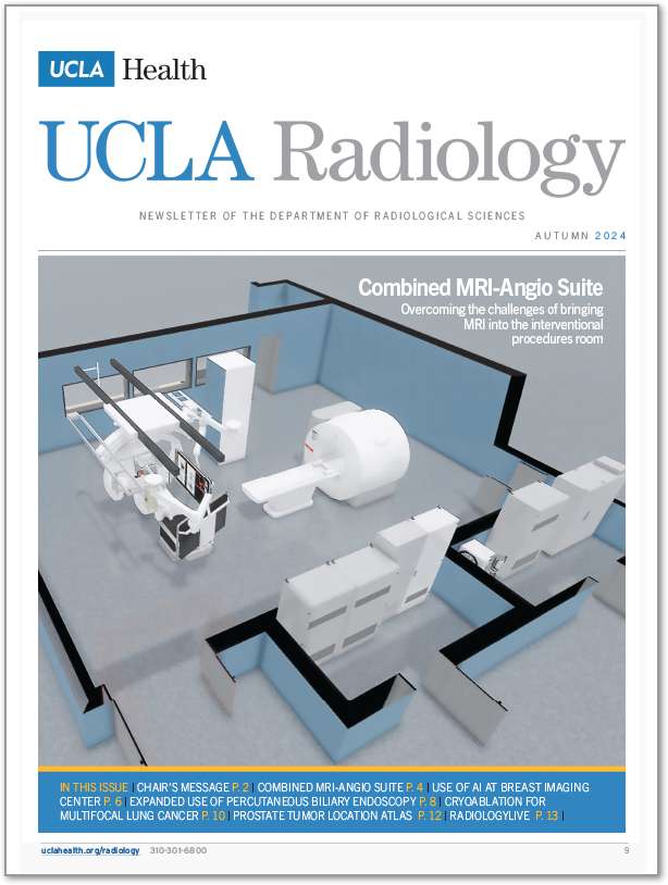 Newsletter - Radiology | UCLA Health