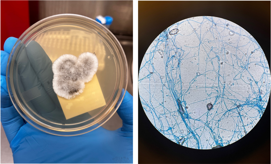 About Transplant Infectious Disease - Transplant ID | UCLA Health