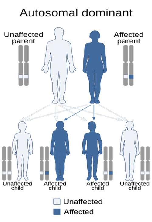 Genetic Syndromes - Rare Endocrine Diseases - Endocrine Surgery | UCLA ...