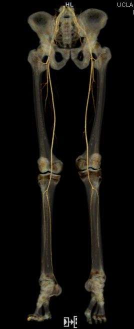 Cardiovascular - Q3D Imaging Lab | UCLA Health