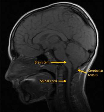 Frequently Asked Questions - Pediatric Neurosurgery | UCLA Health