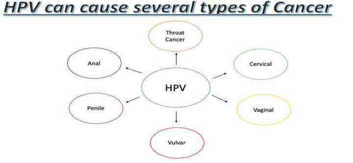 What is HPV? - Head & Neck Surgery | UCLA Health