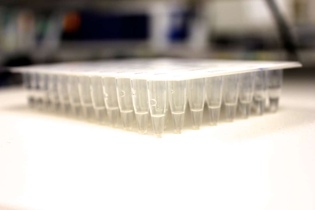 Immunogenetics (UIC) - Pathology | UCLA Health